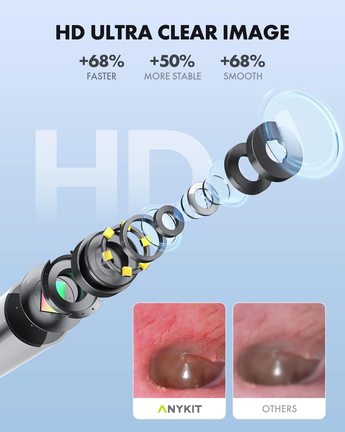 Wireless Otoscope Ear Camera with Dual View, 3.9mm 720PHD WiFi Ear Sco ...