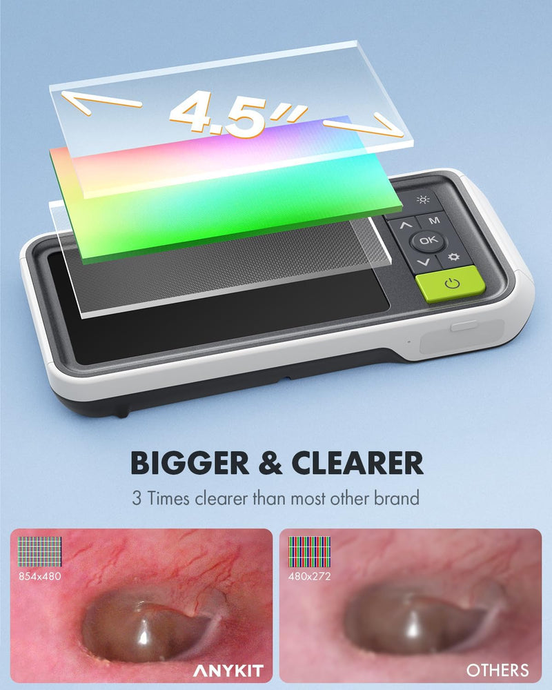 Anykit Digital Otoscope with Gyroscope, 4.5 Inches Screen, 3.9mm Ear S
